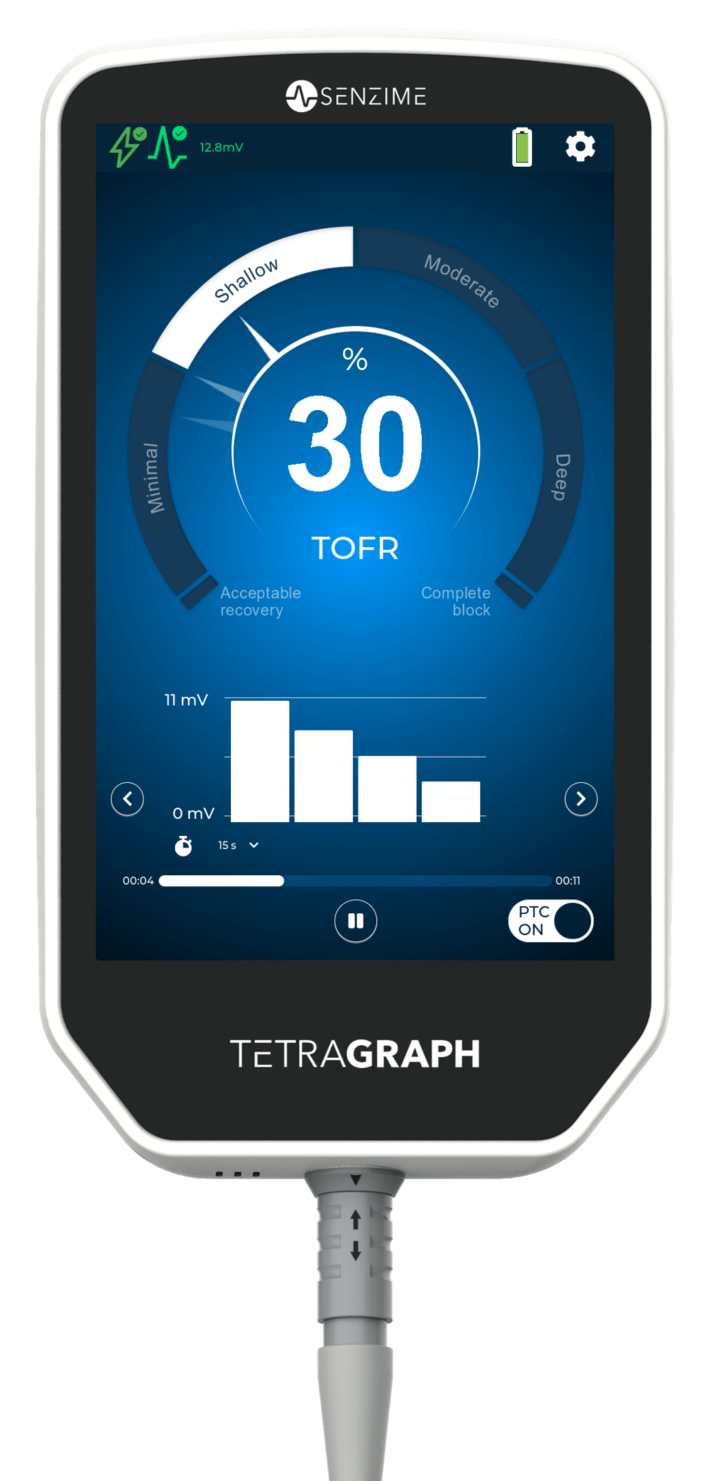 Neuromuscular Monitoring System - Next-Generation TetraGraph | Duomed